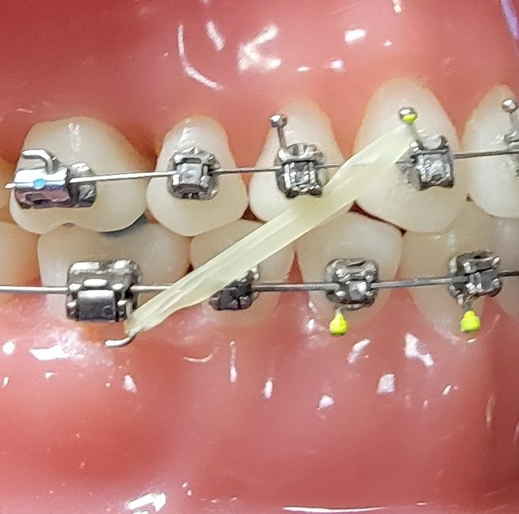 First Visit - Buckman Orthodontics